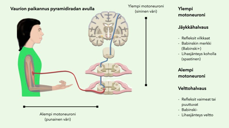 Neurologinen statustutkimus – Neurobasket